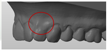 Common Issues with Impressions – ProMonitoring